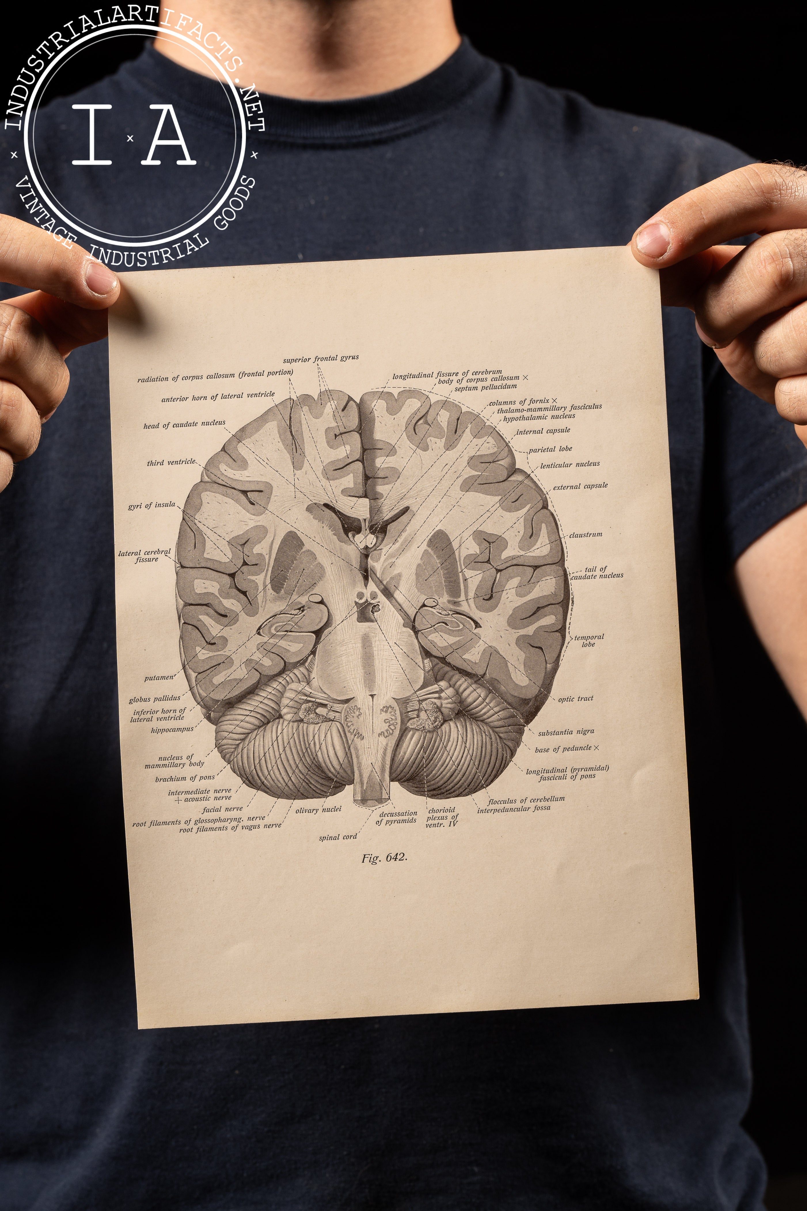 Antique Print Brain Diagram – Industrial Artifacts